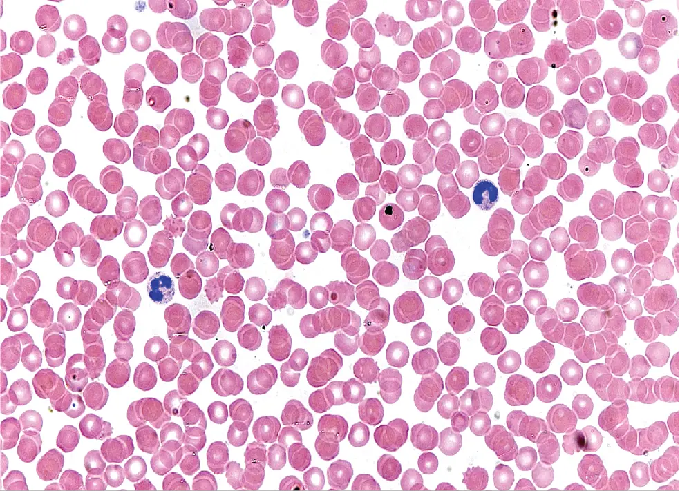 Lesson 7 Grow Your Own Yeasts And Use A Hemocytometer To “count Cell