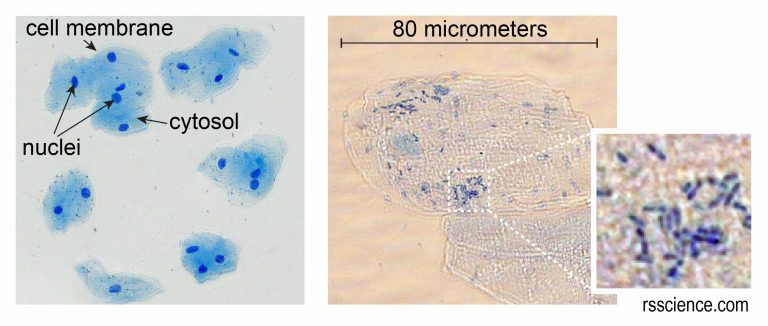 Biological Stains for Microscope You Can Find at Home - Rs' Science