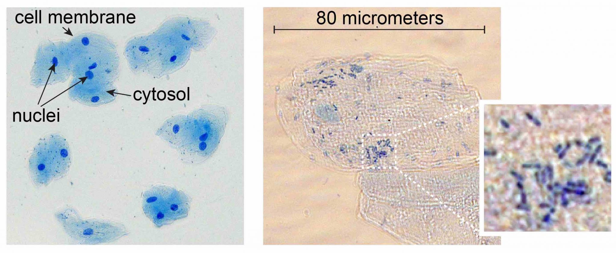 Eukaryotes and Prokaryotes - What are the Similarities, Differences ...