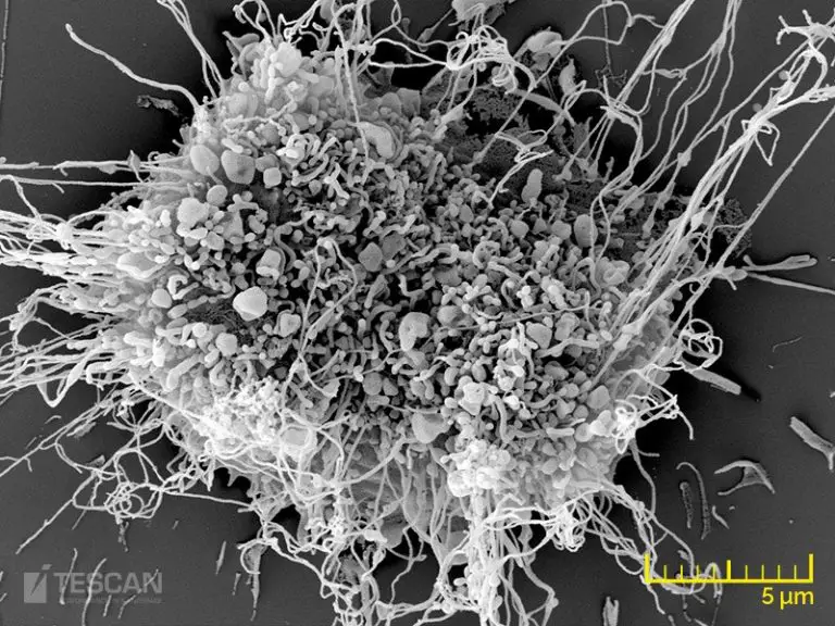 5 Science Facts Behind Astonishing Electron Microscope Images - Rs' Science