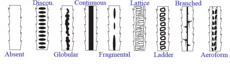 Hair Under a Microscope - Rs' Science