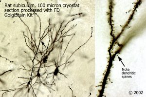 Golgi Apparatus Function – the Post Office inside the Cells - Rs' Science