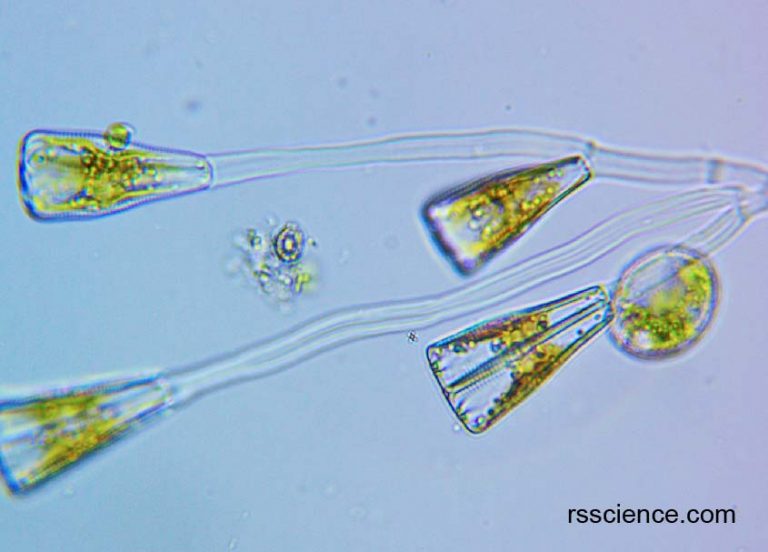 Diatoms - Rs' Science