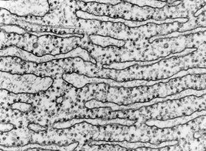 Ribosome - protein factory - definition, function, structure and biology