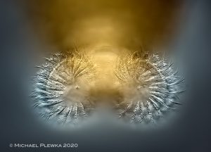 Facts about Rotifers – Amazing Microscopic Animals under the Microscope