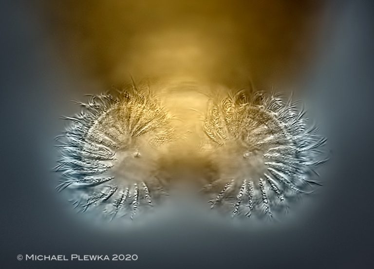 Facts about Rotifers – Amazing Microscopic Animals under the Microscope