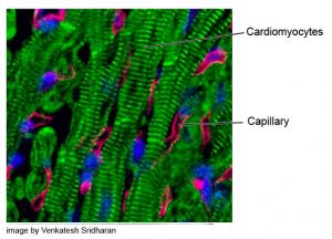 Cardiomyocytes (Cardiac Muscle Cells) - Structure, Function, Cell ...