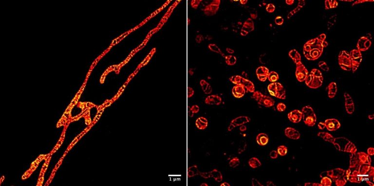 Mitochondria - the powerhouses of the cell - definition, structure ...