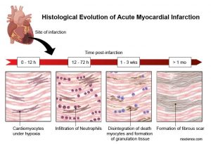 Cardiomyocytes (Cardiac Muscle Cells) - Structure, Function, Cell ...