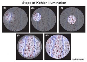 What is Kohler illumination, why is it important, and how to do it?