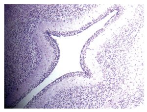 What is Kohler illumination, why is it important, and how to do it?