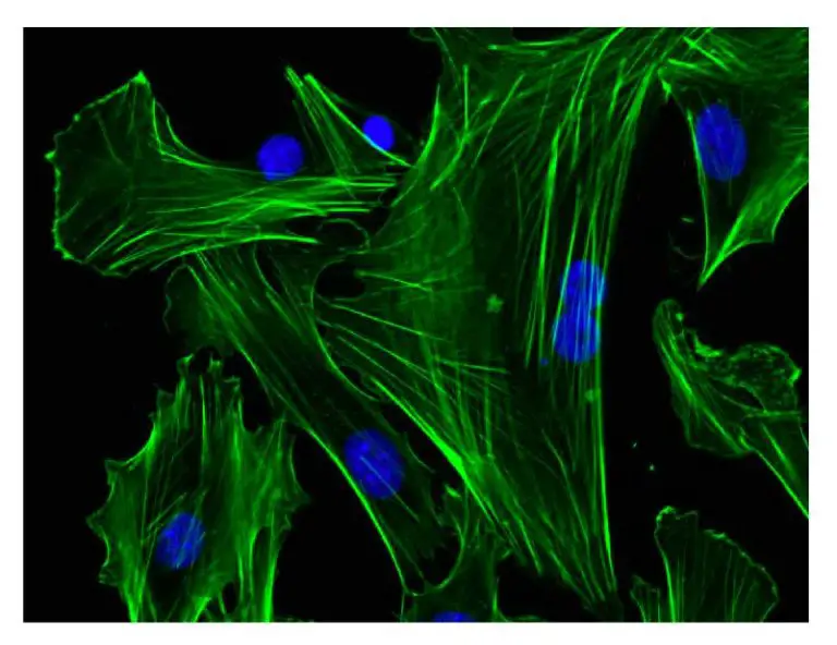 Cytoskeleton - the muscle and the bone of a cell - definition ...