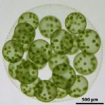 Volvox – The emerald green algae of the micro world