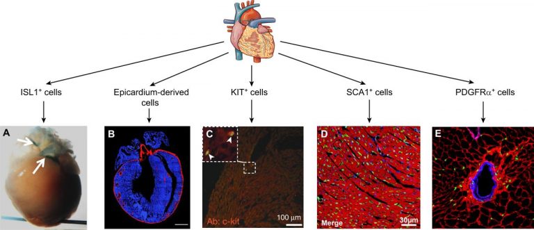 Cardiomyocytes (Cardiac Muscle Cells) - Structure, Function, Cell ...