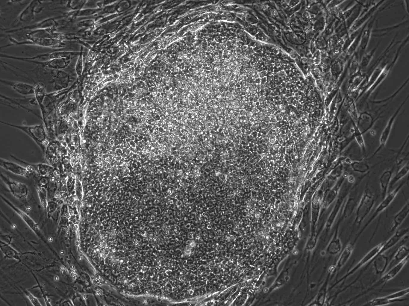 What is an induced pluripotent stem cell (iPSC)? - Rs' Science