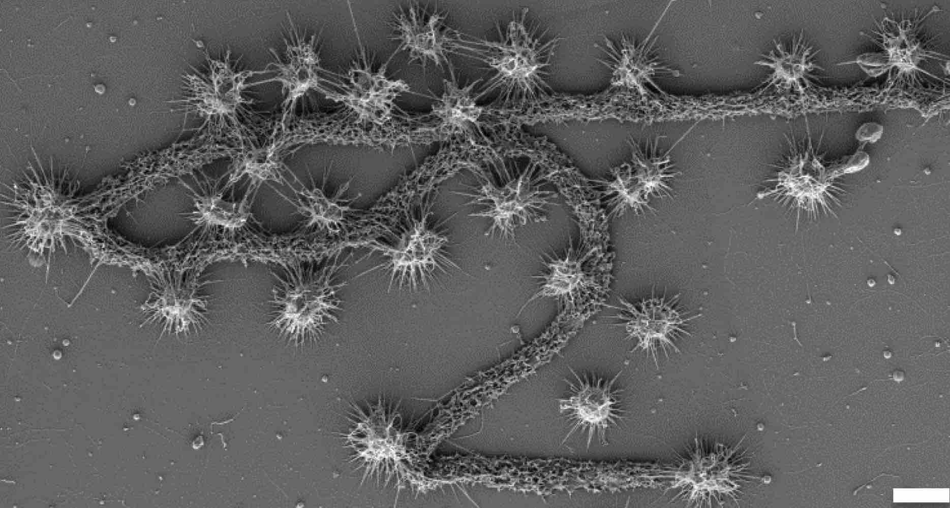 Archaea - Definition, Structure, Types & Extremophile Habitats - Rs ...