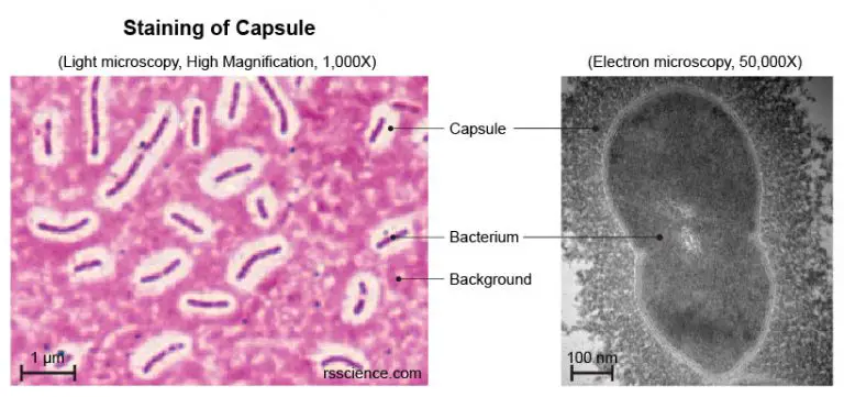 Bacteria - Definition, Structure, Types & Infections - Rs' Science