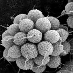 Synura – Biology, Classification, Characteristics, and Reproduction ...